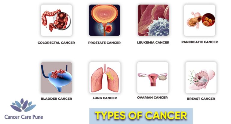 Types Of Cancer - Dr. Jagdish Shinde